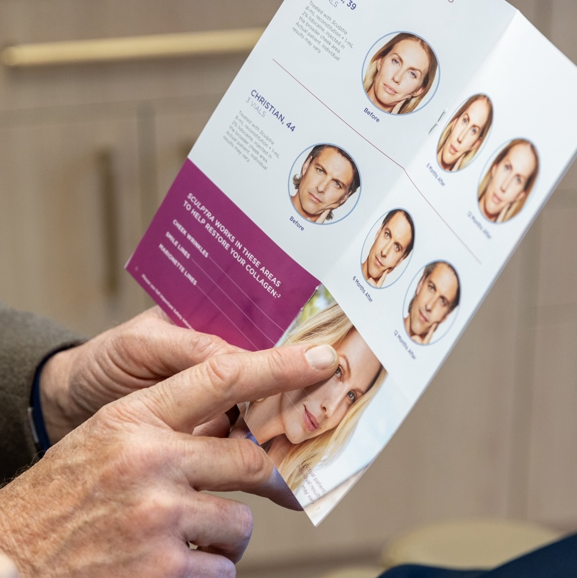 Upper Eyelid Plastic Surgery in Atlanta | Artisan Plastic Surgery